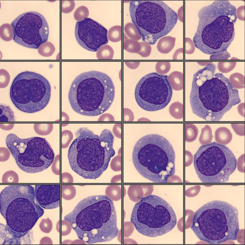 Monthly Cell Challenge #4 / 2025 | CellaVision